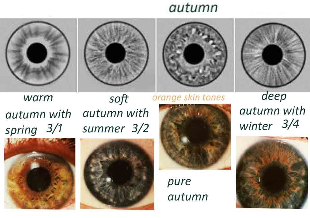 What Is Iris Color Chart Iriscope Iridology Camera Iriscope