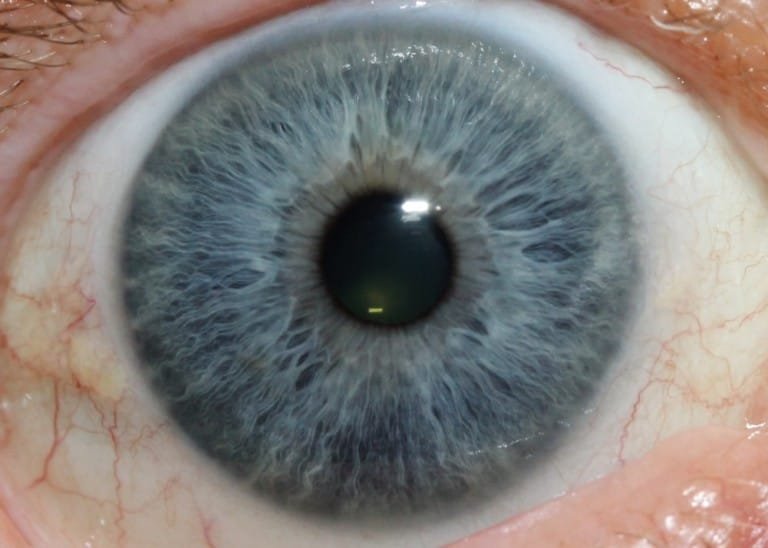 The Anatomy Of An Iris Under The Iridology Camera | MAIKONG