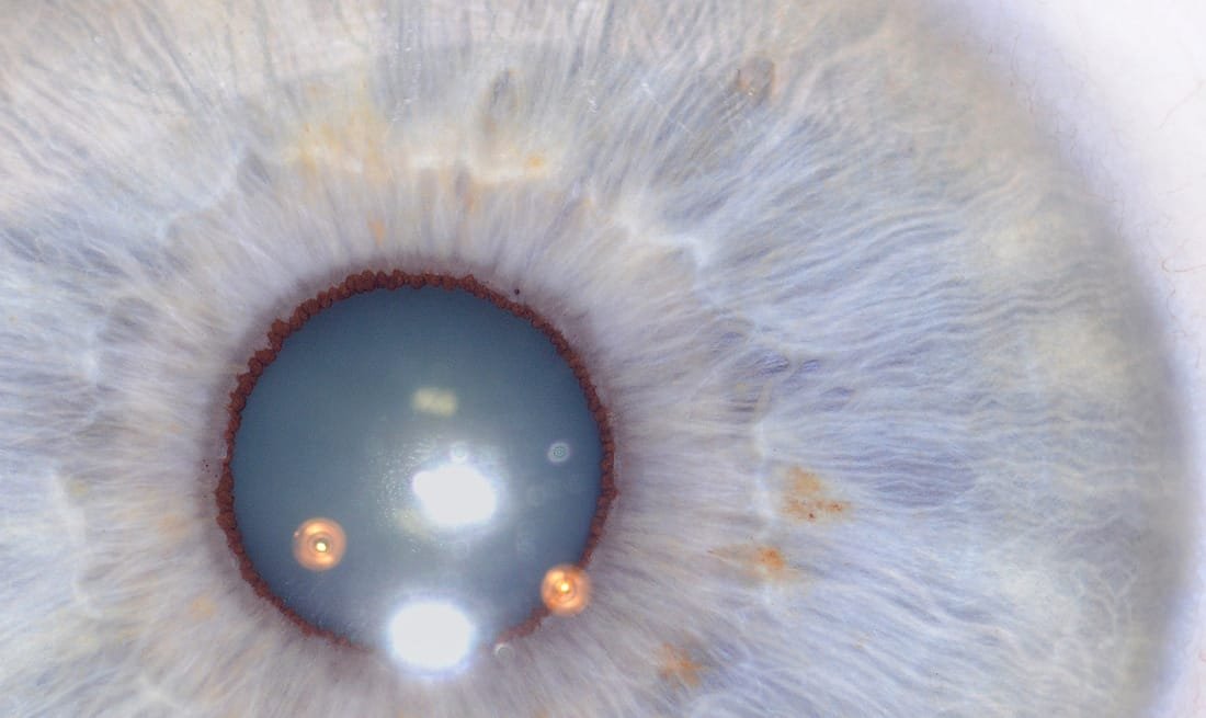 iridology images 4