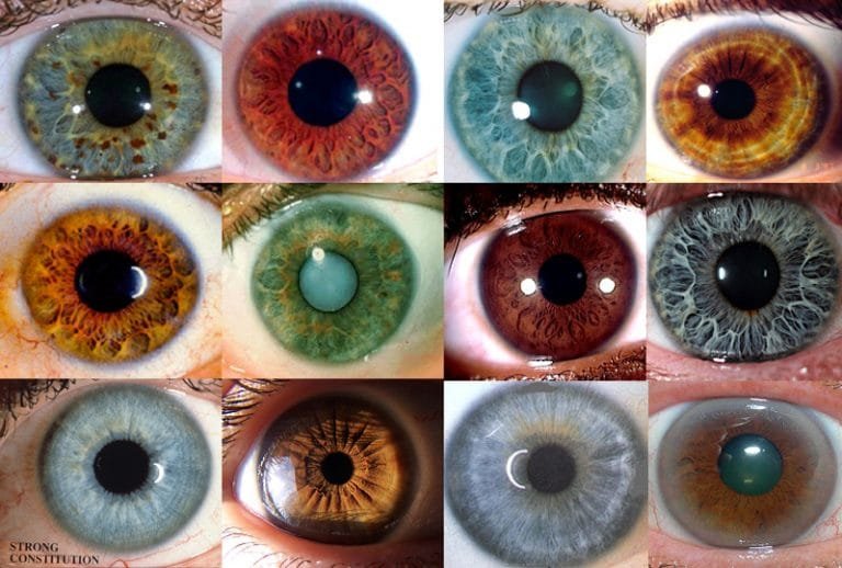What Is An Iridologist? A Guide To Iris Diagnosis Practices