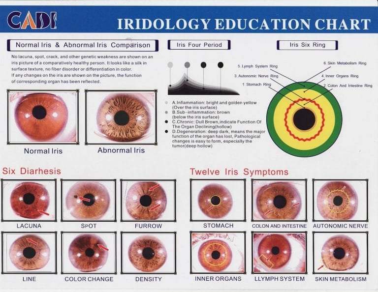 Free Iridology Chart – MAIKONG Iridology Camera - Iriscope-Leading ...