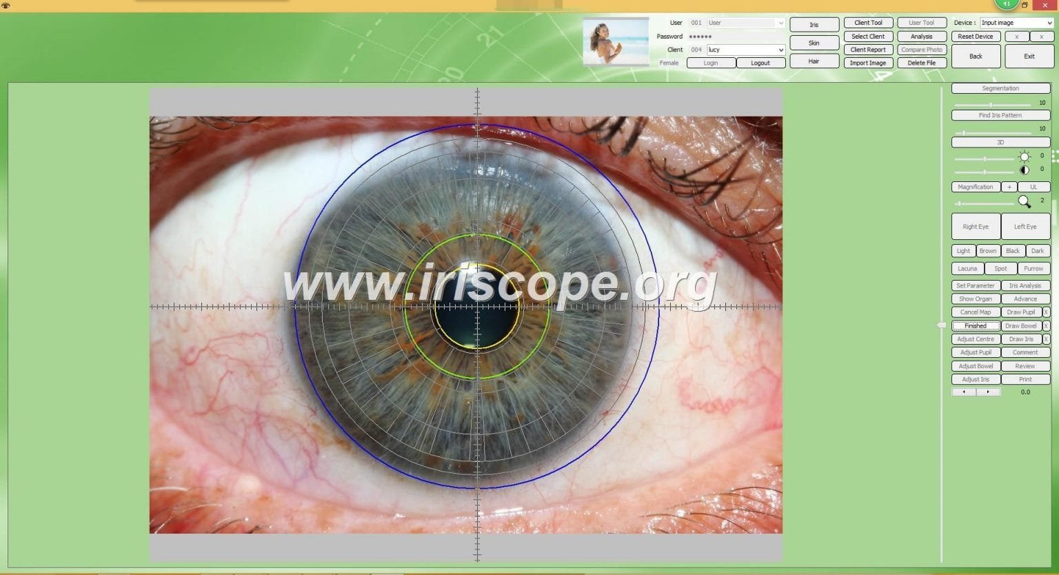 Unveiling The Wonders Of Iridology Camera: A Comprehensive Guide – MAIKONG Iridology Camera ...
